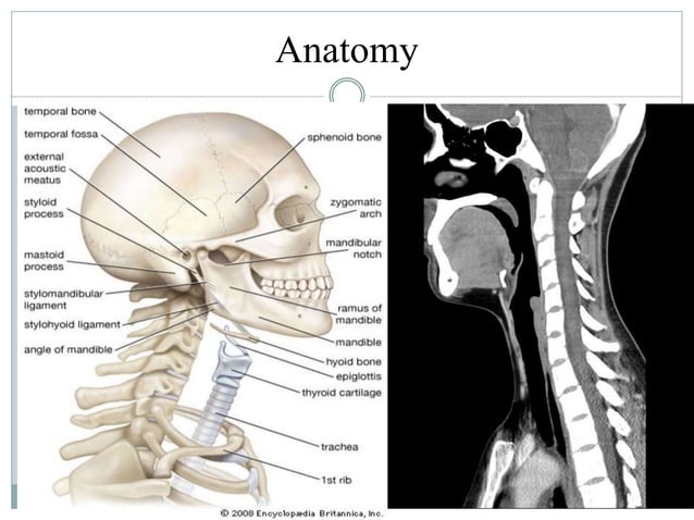 CT procedure of neck | PPTX
