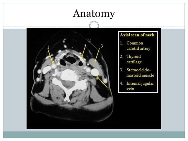 CT procedure of neck | PPTX