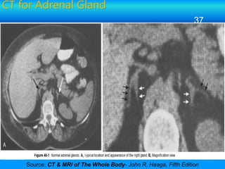 CT Procedure OF Abdomen & Pelvis | PPTX