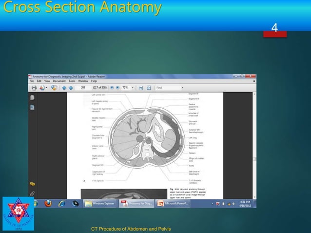 CT Procedure OF Abdomen & Pelvis | PPTX | Digestive Disorders ...