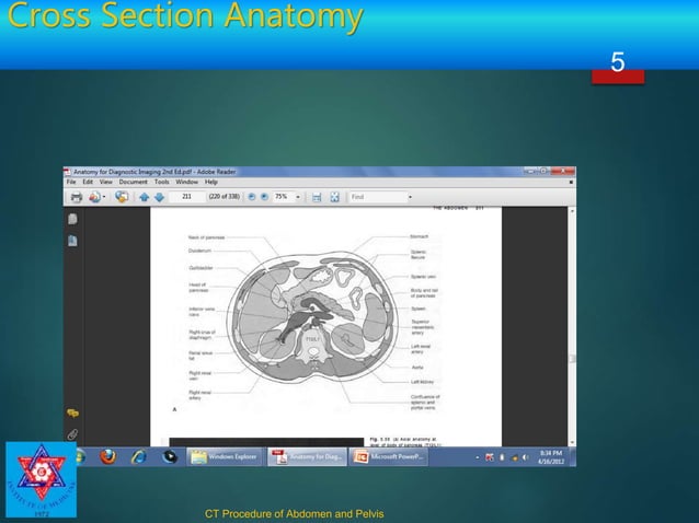 CT Procedure OF Abdomen & Pelvis | PPTX | Digestive Disorders ...