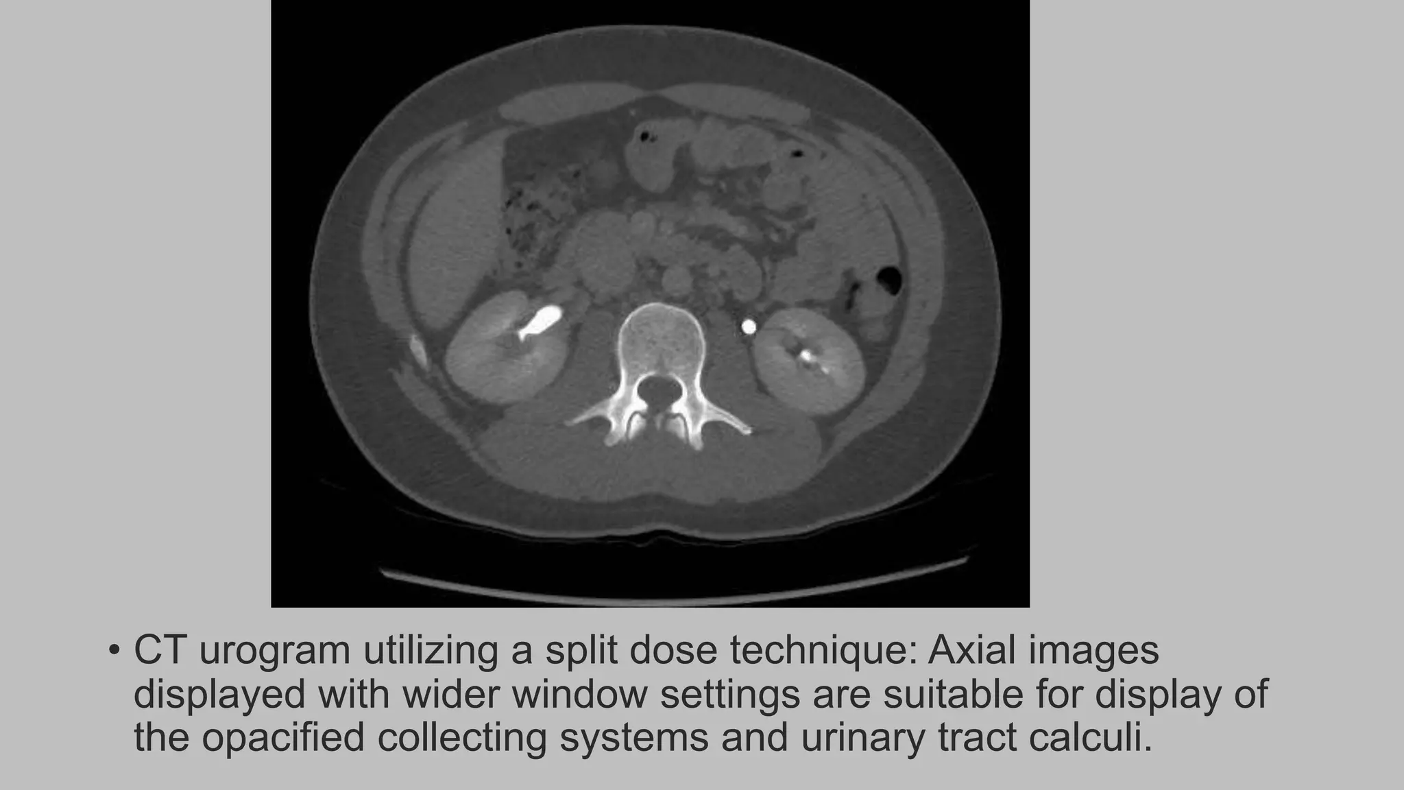 Ct protocol for ivu | PPTX