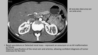 Ct protocol for ivu | PPTX