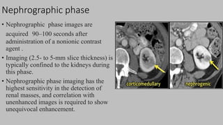 Ct protocol for ivu | PPTX