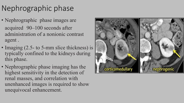 Ct protocol for ivu | PPTX