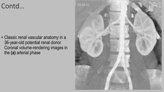 Ct protocol for ivu | PPTX