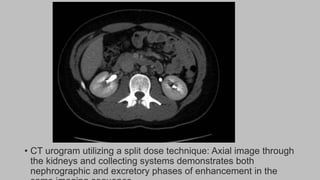 Ct protocol for ivu | PPTX
