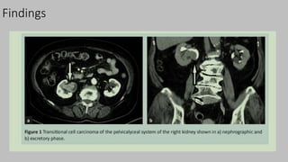 Ct protocol for ivu | PPTX