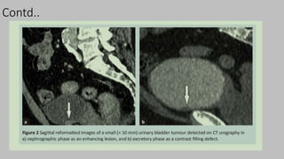 Ct protocol for ivu | PPTX