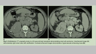 Ct protocol for ivu | PPTX