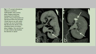 Ct protocol for ivu | PPTX