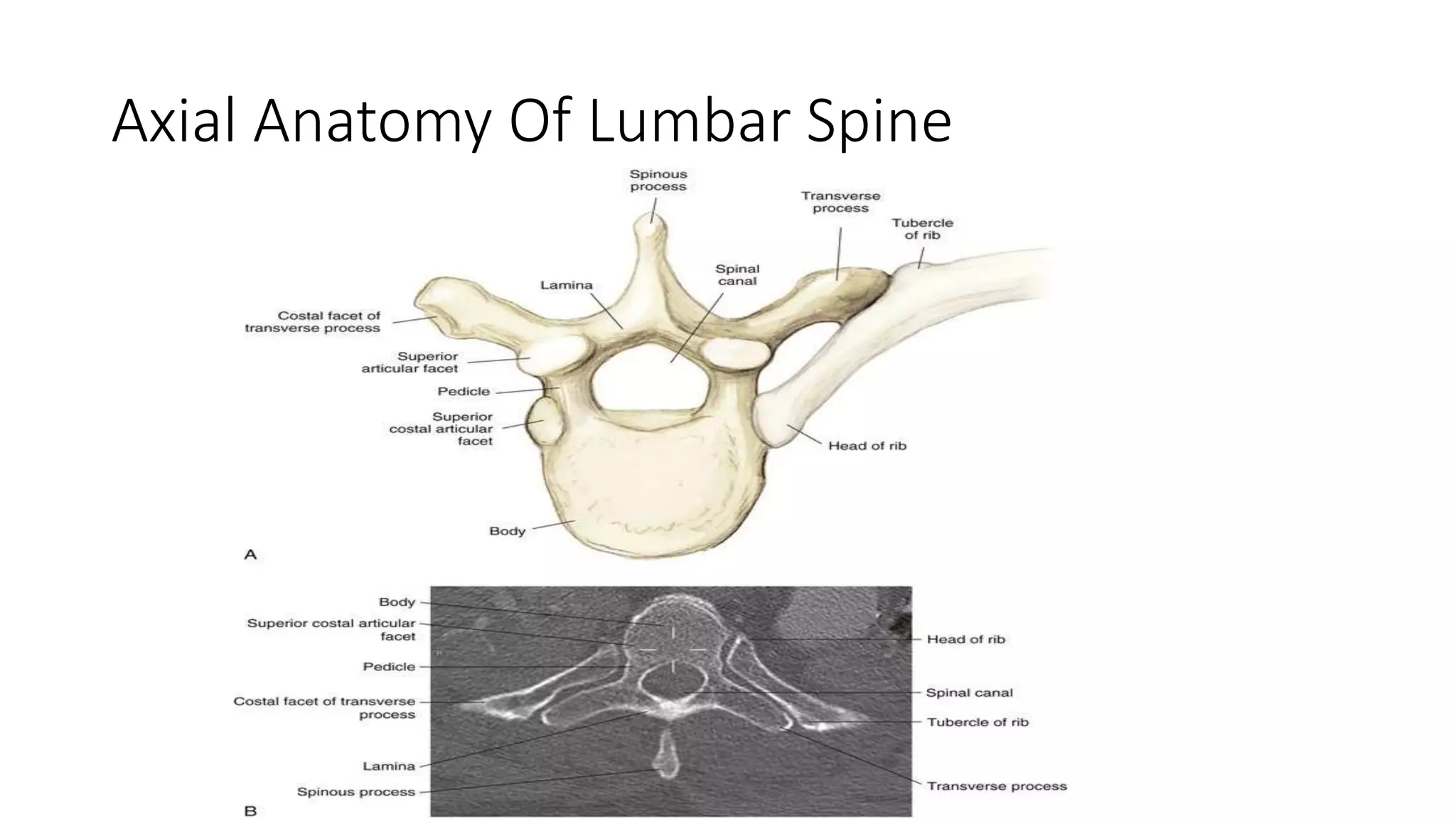CT protocol of Spine | PPTX