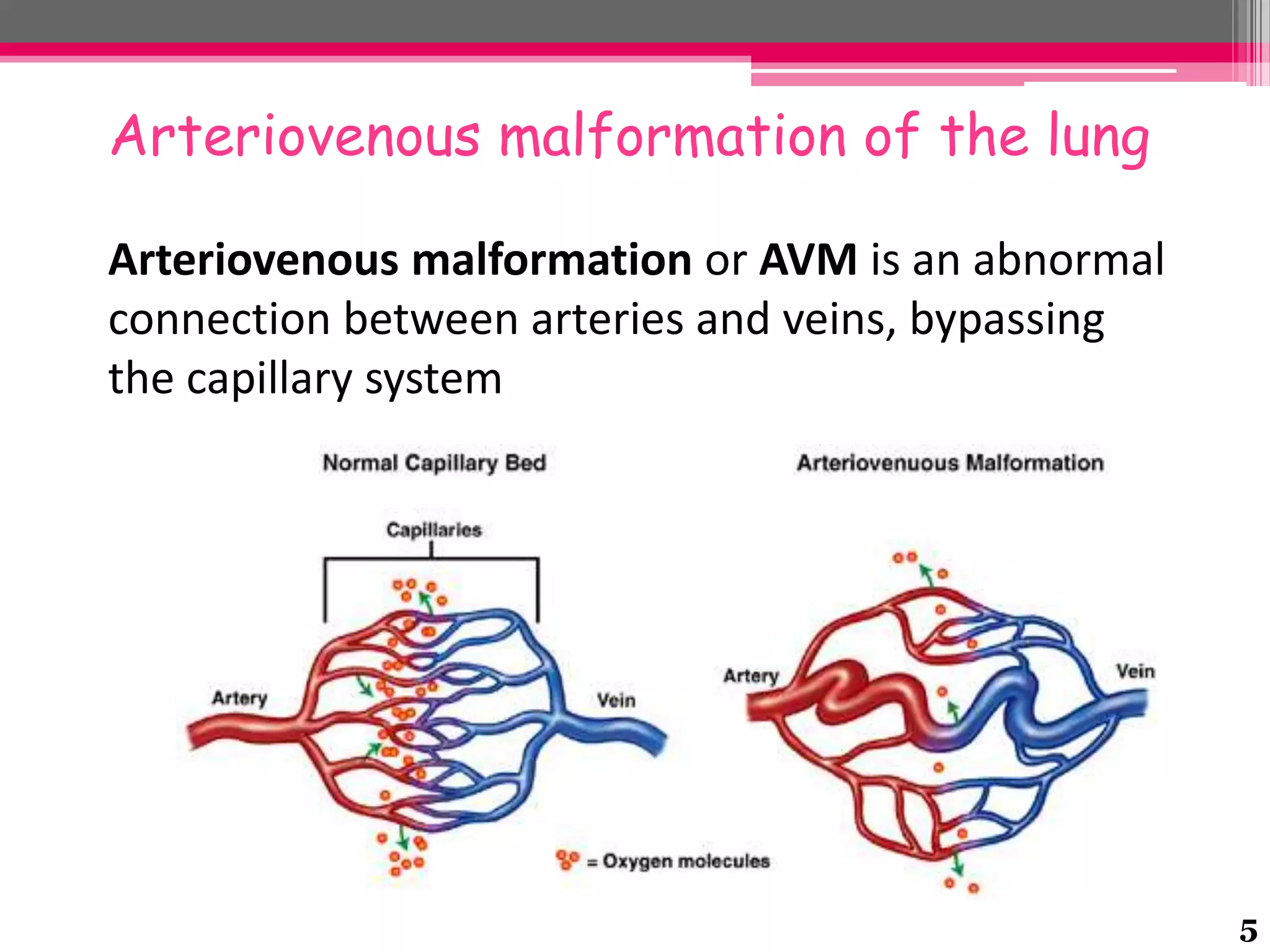 Ct pulmonary angiogram (ctpa) | PPTX