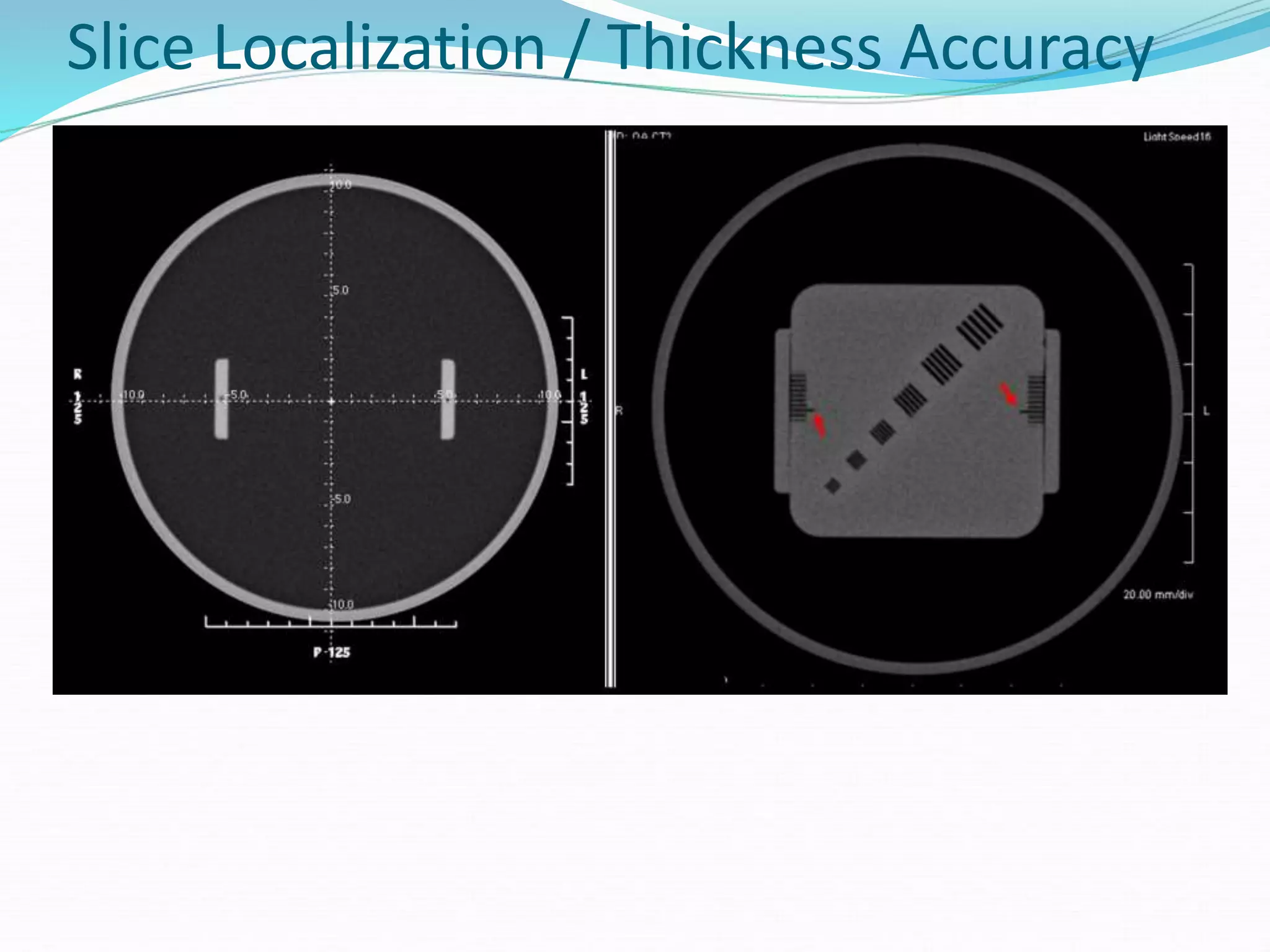 Ct quality control | PPTX