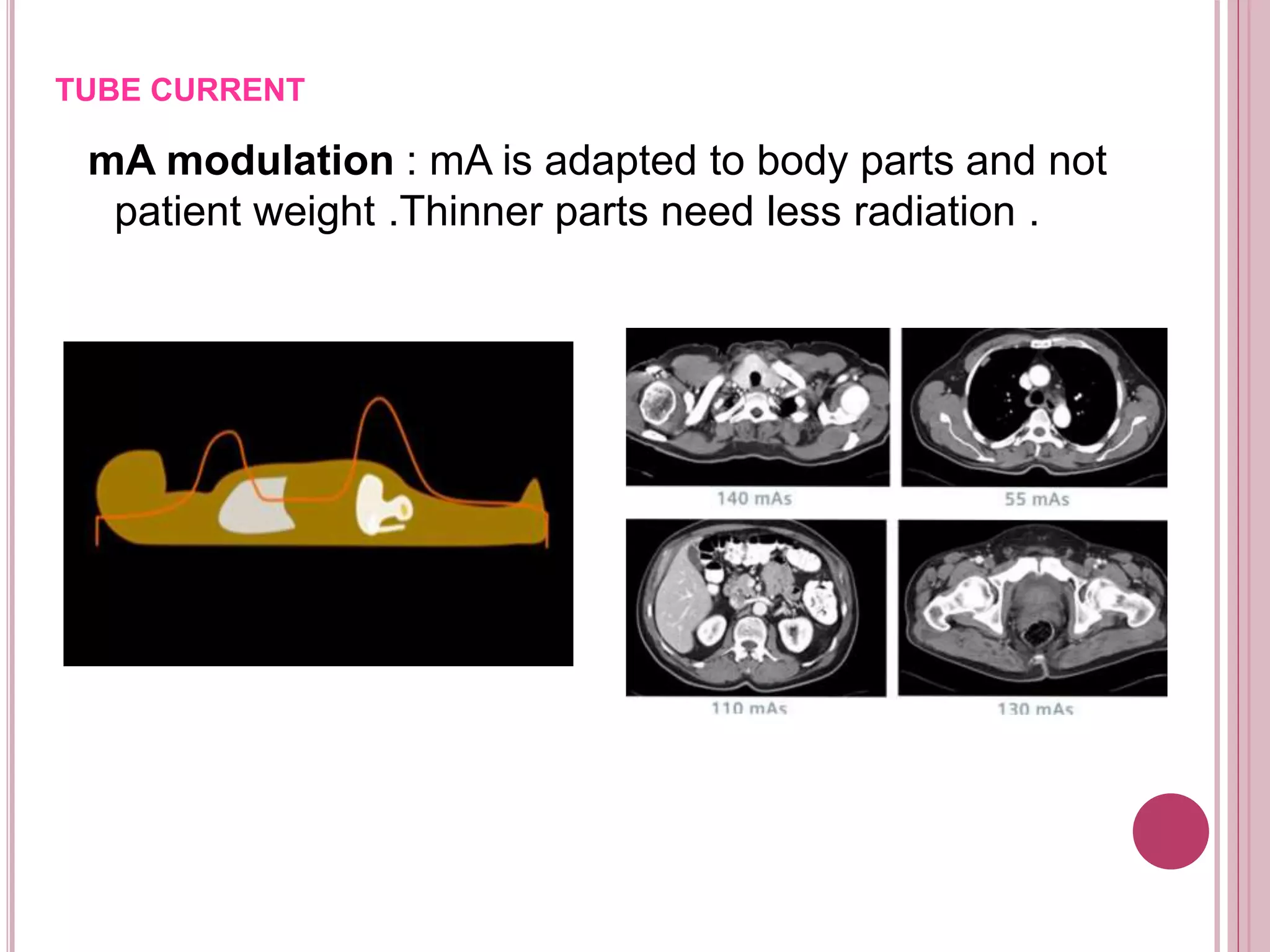 Ct Radiation Dose Reduction Pptx