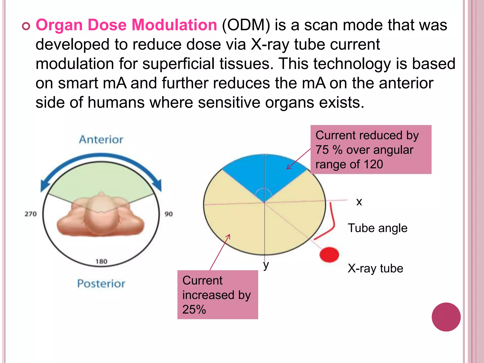 Ct Radiation Dose Reduction Pptx