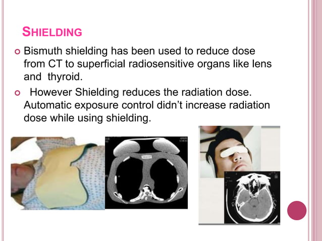 CT RADIATION DOSE REDUCTION | PPTX | Digital Audio | Computer Software ...