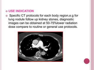 CT RADIATION DOSE REDUCTION | PPTX