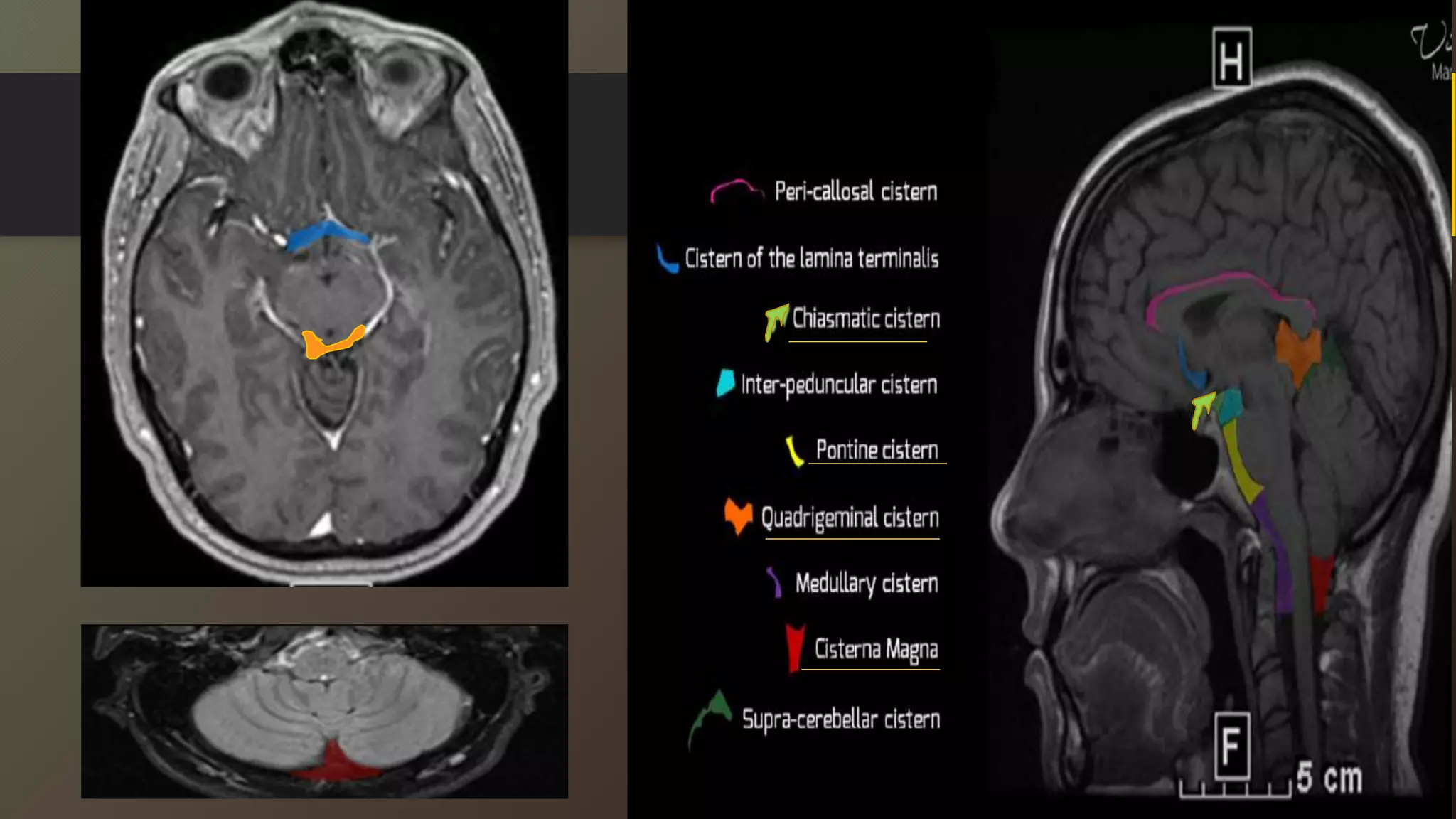 brian CT introdaction pediatric radiology | PPTX