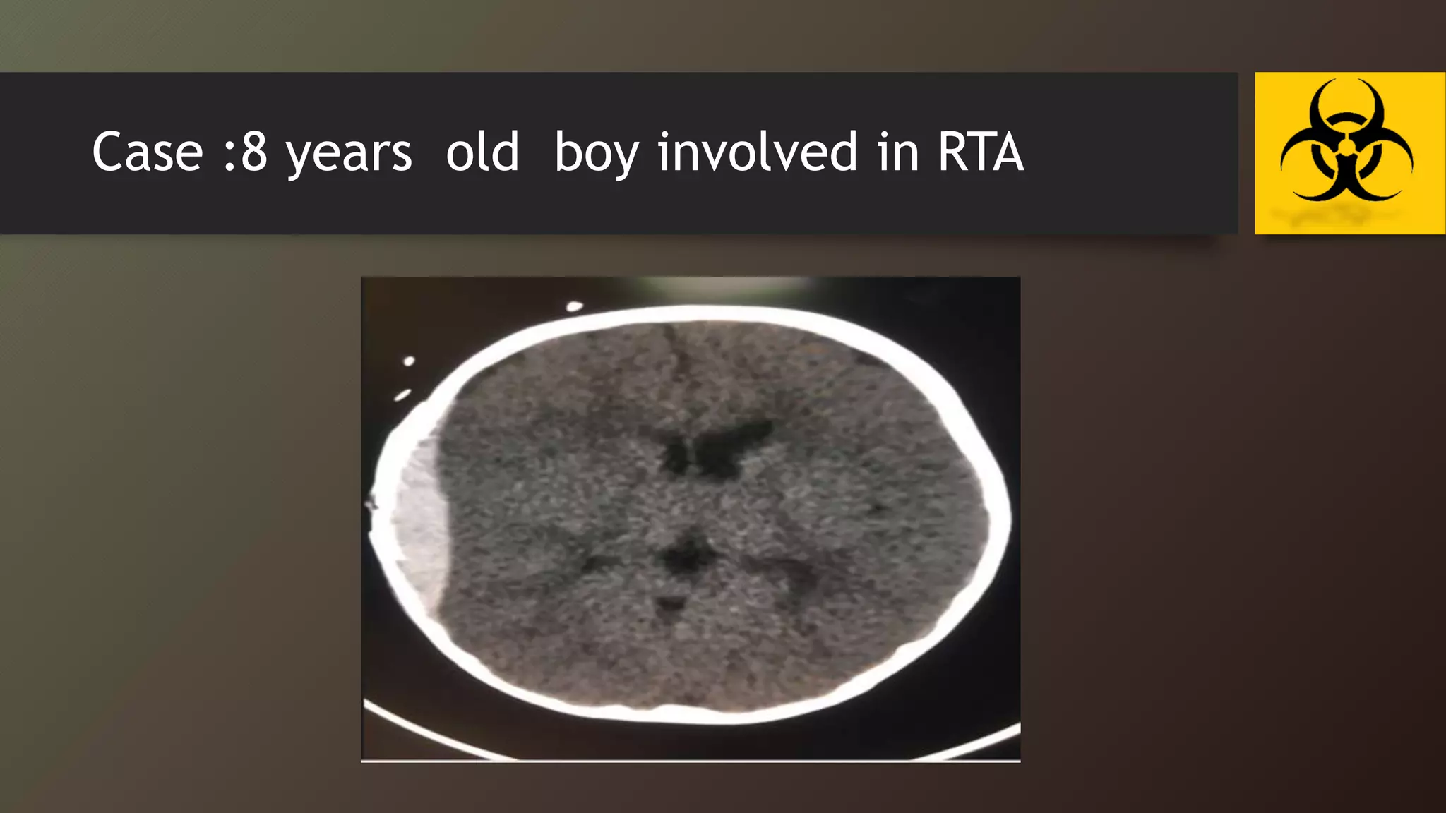 brian CT introdaction pediatric radiology | PPTX