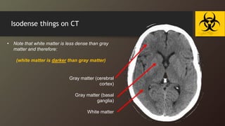 brian CT introdaction pediatric radiology | PPTX