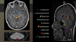 brian CT introdaction pediatric radiology | PPTX