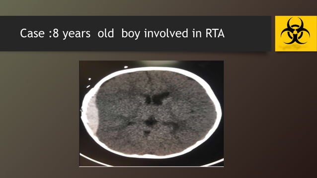 brian CT introdaction pediatric radiology | PPTX