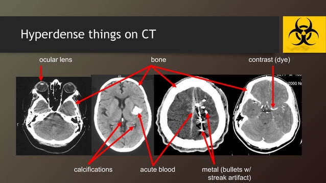 brian CT introdaction pediatric radiology | PPTX