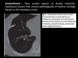 CT scan of Rib pathologies | PPTX