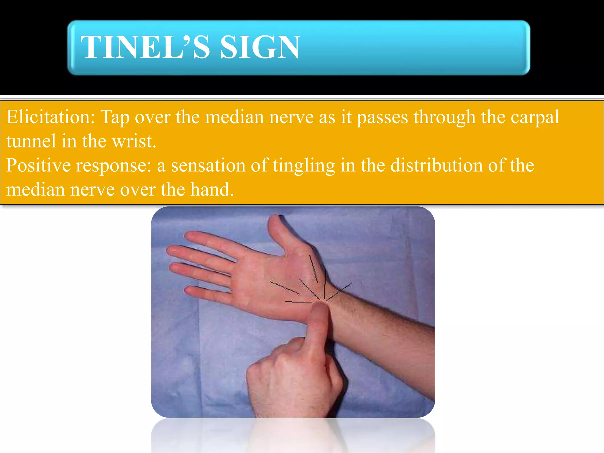CARPAL TUNNEL SYNDROME ANATOMY AND RADIOLOGY IMAGING FINDINGS | PPTX