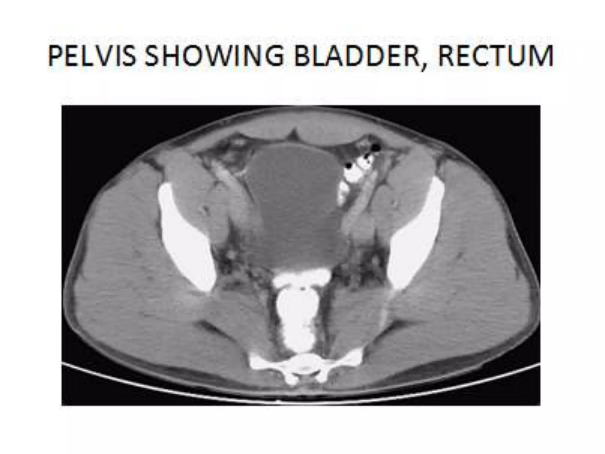 Ct scan | PPTX