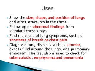 Ct scan | PPTX