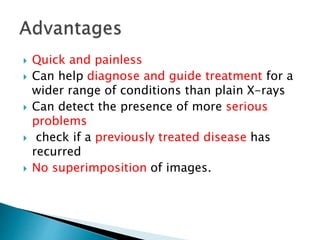 Ct scan | PPTX