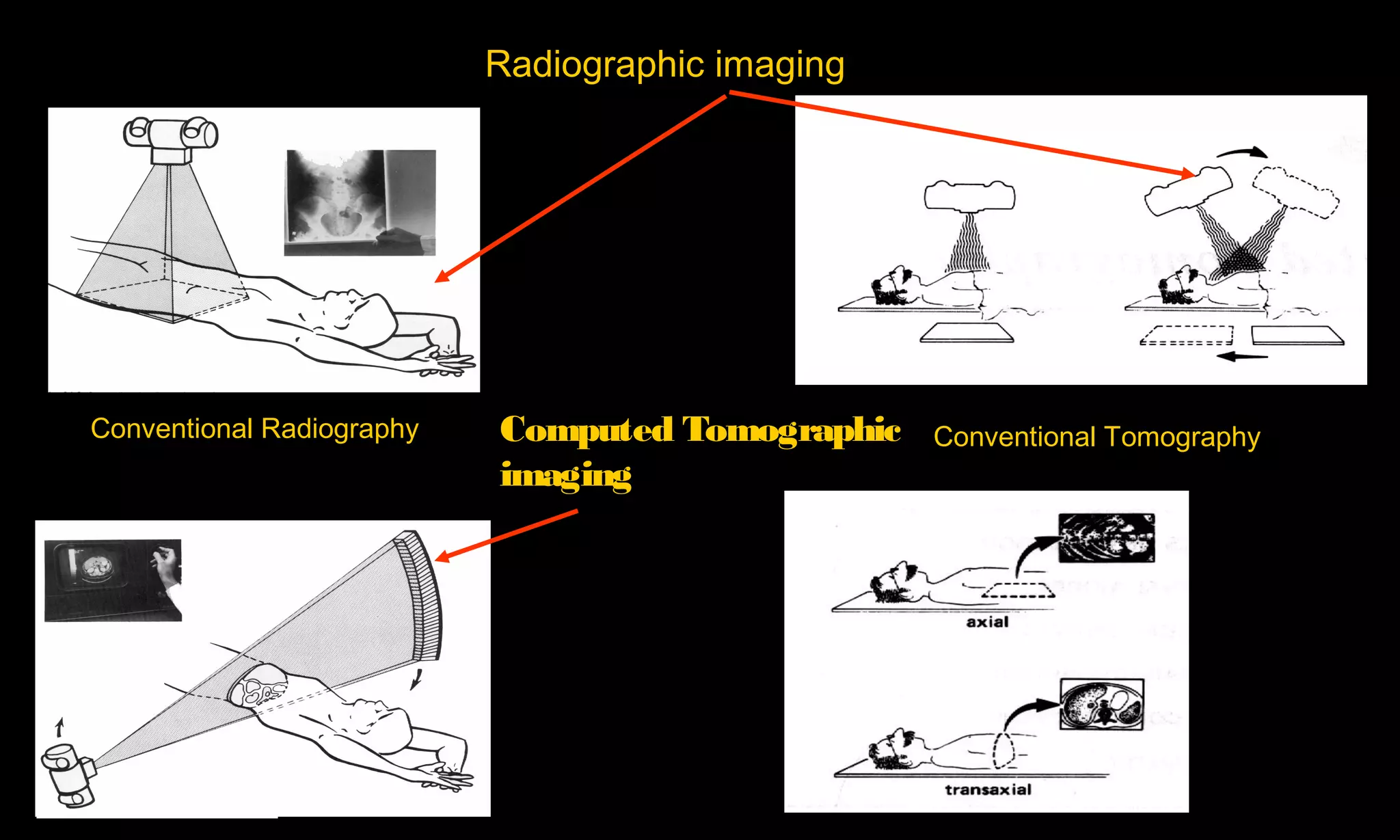 Ct scan | PPT