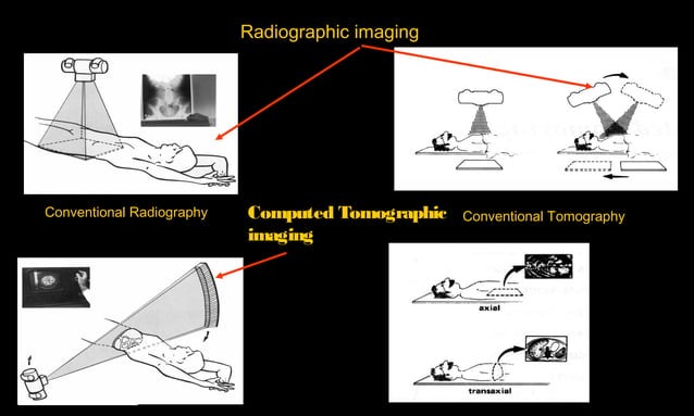 Ct scan | PPT