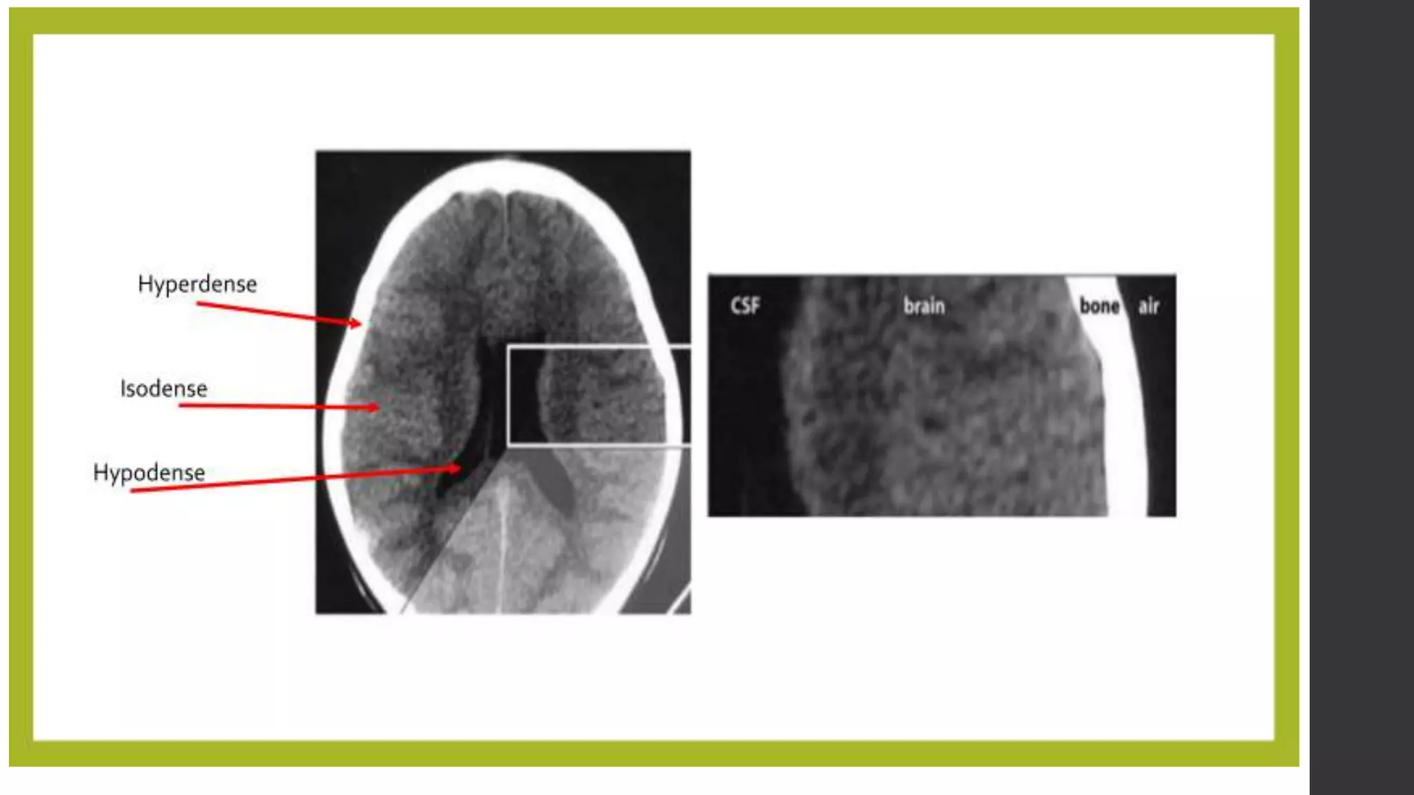 ct scan.pptx | Free Download