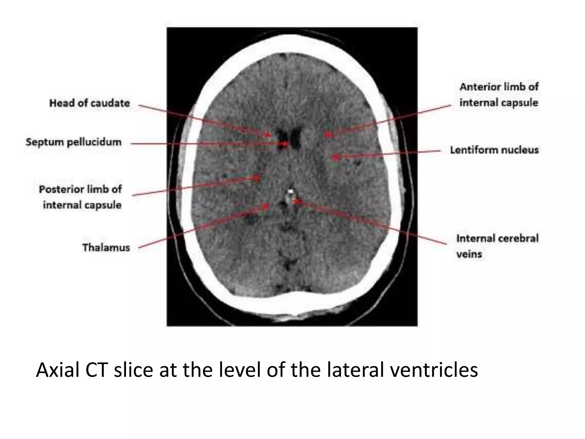 CT scan.pptx