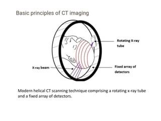 CT scan.pptx