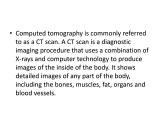CT scan.pptx