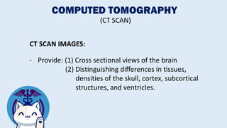 Unlocking the Marvels of CT Scans: A Heartwarming Guide for Easy ...