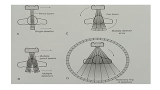 COMPUTED TOMOGRAPHY (CT)simple way to learn | PPTX