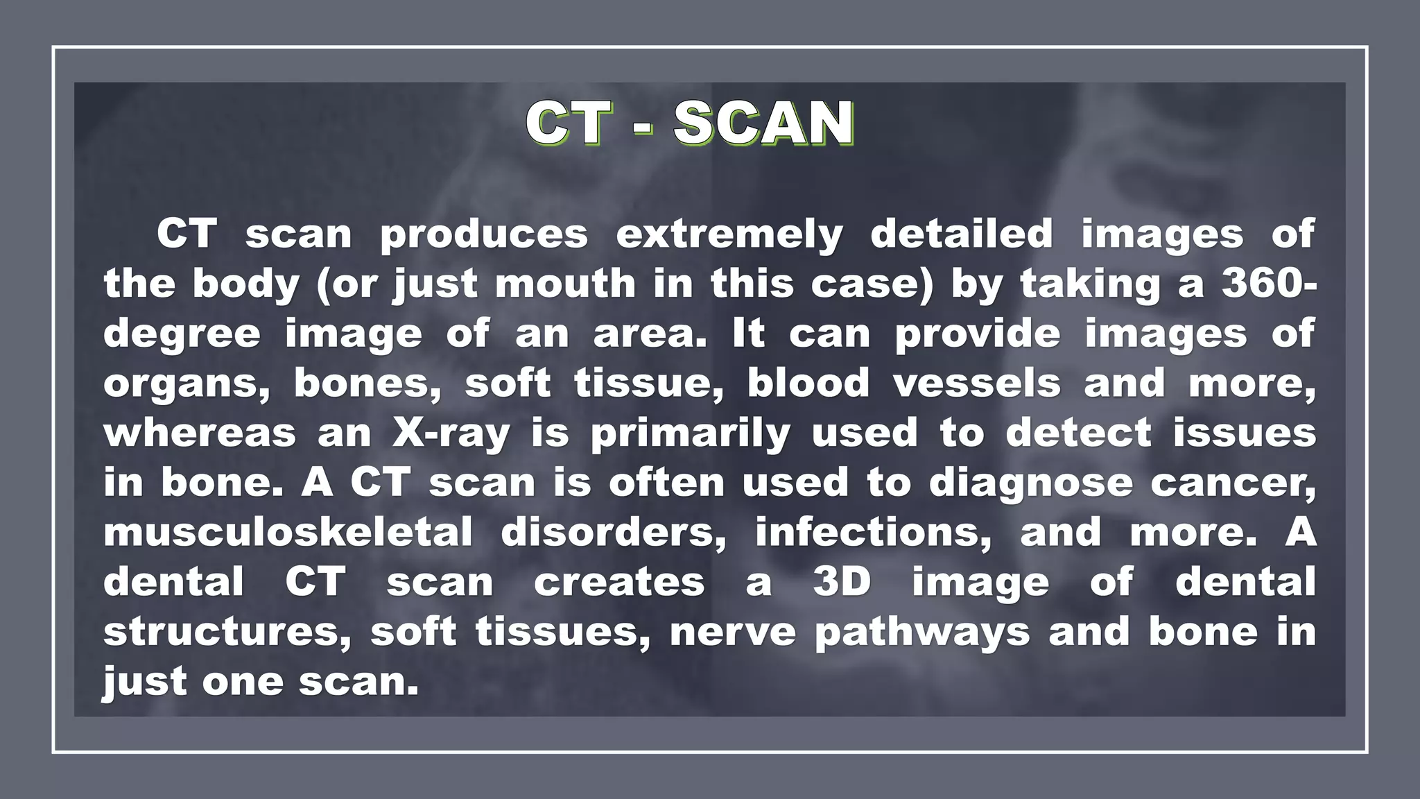 CT SCAN - MRI.pptx