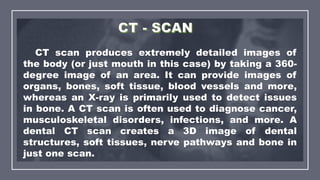 CT SCAN - MRI.pptx