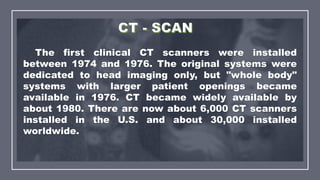 CT SCAN - MRI.pptx