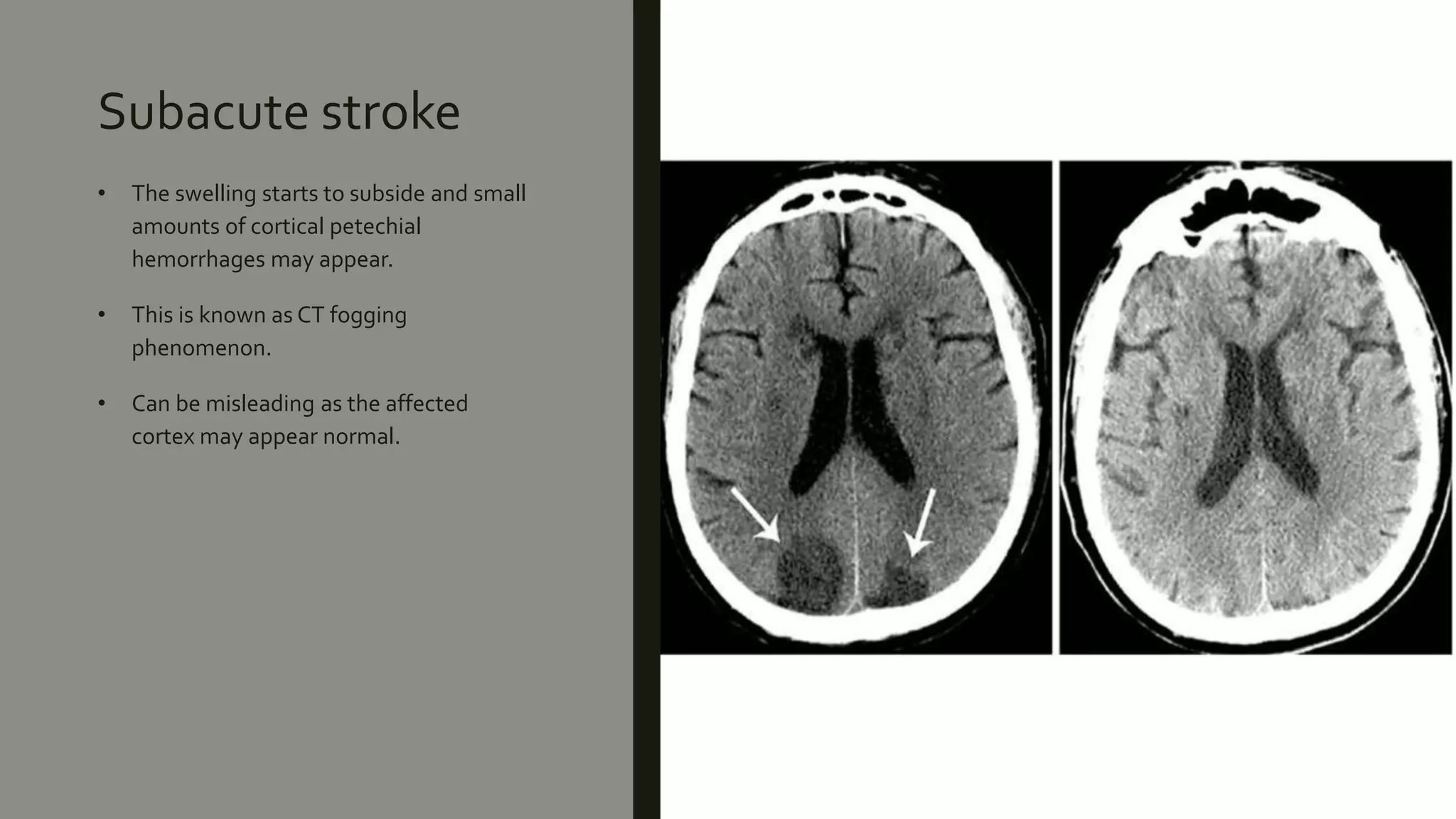 Ct scan agp | PPTX