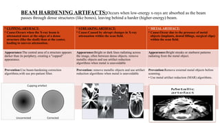 CT-Scan Artifacts and their Types .pptx
