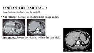 CT-Scan Artifacts and their Types .pptx