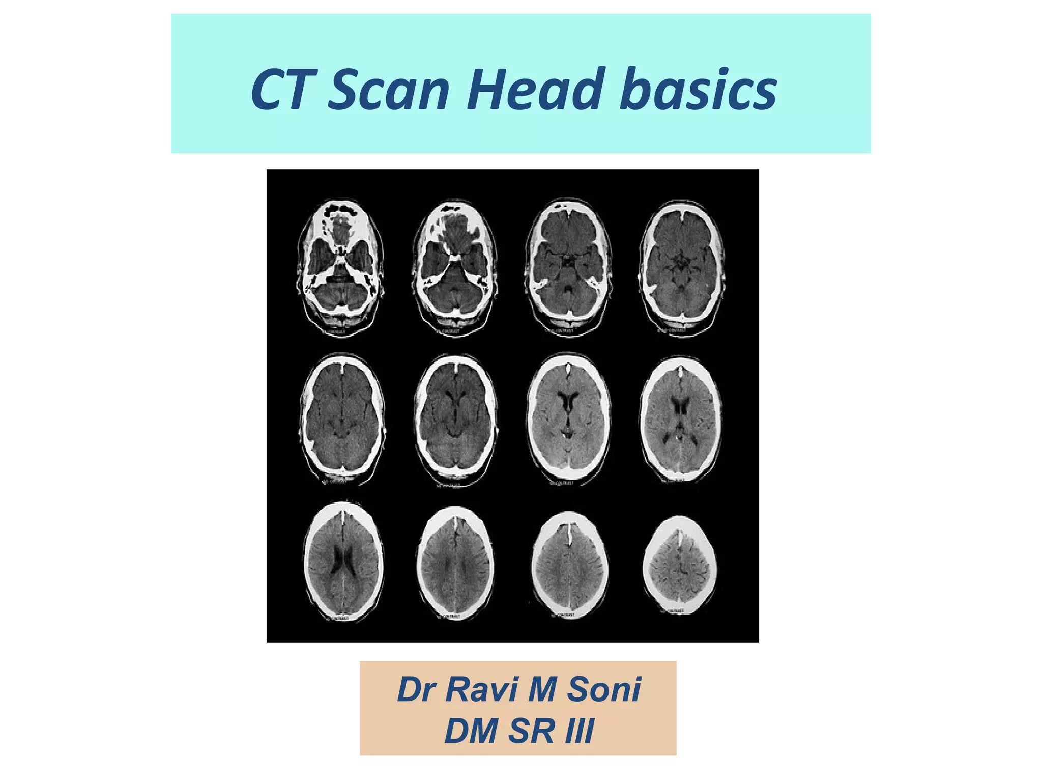 CT Scan Head basics | PPT