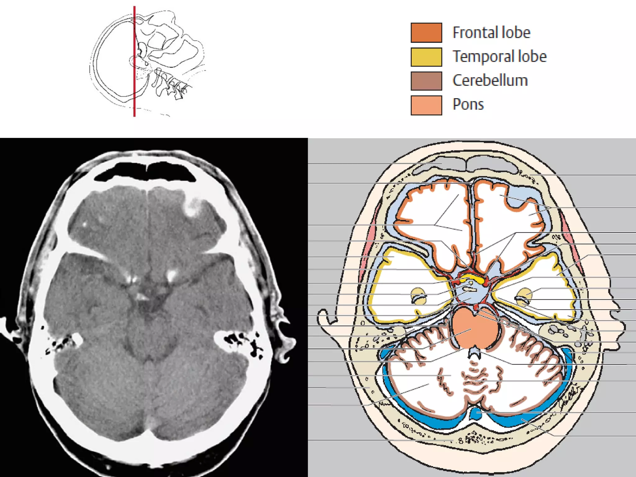 CT Scan Head basics | PPT
