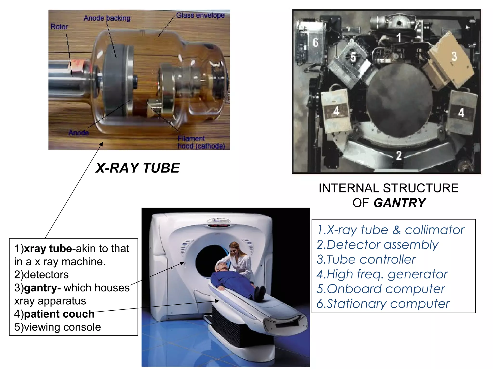 CT Scan Head basics | PPT